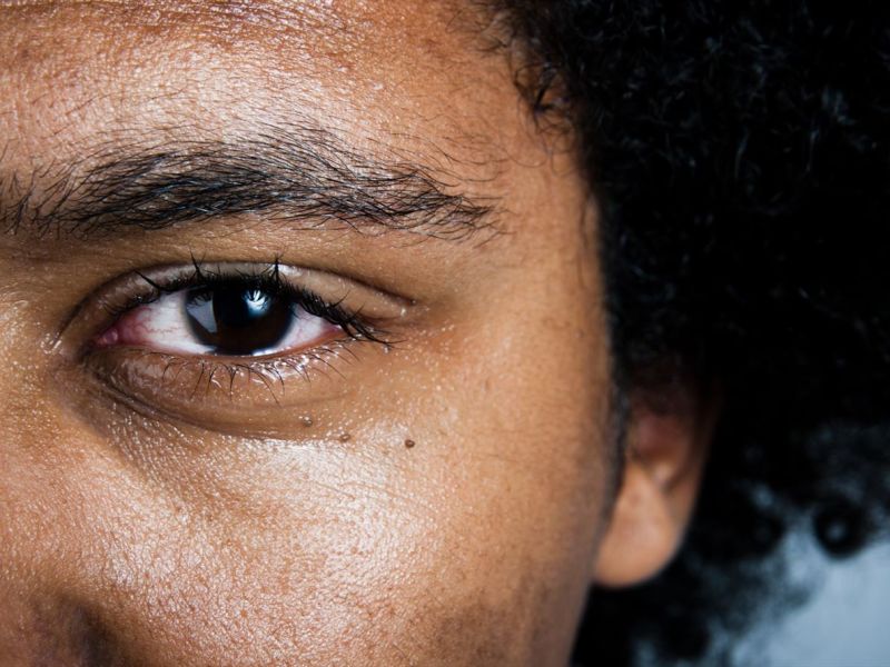 Trachoma: Nursing assessment and interventions