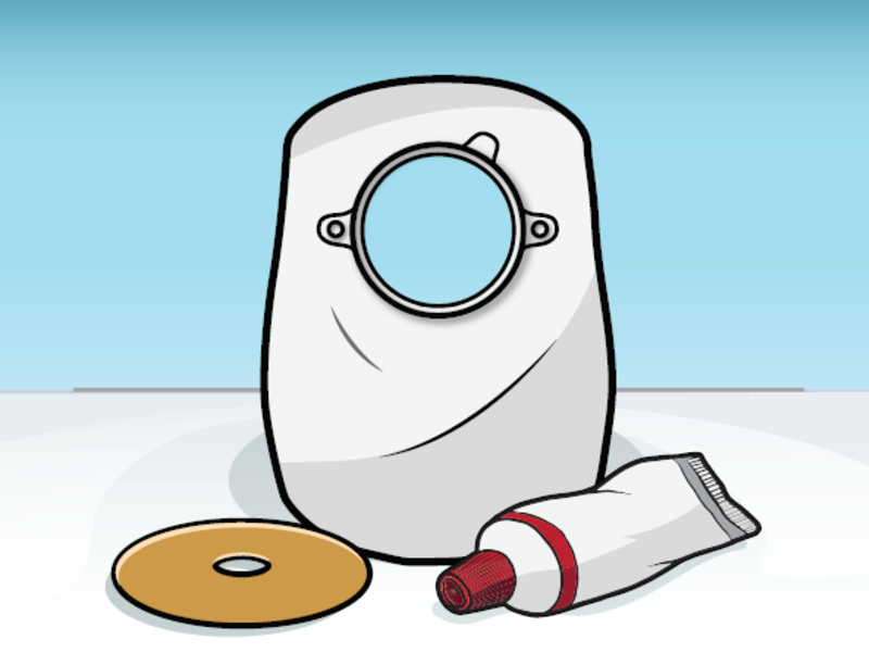Ostomy (stoma) care