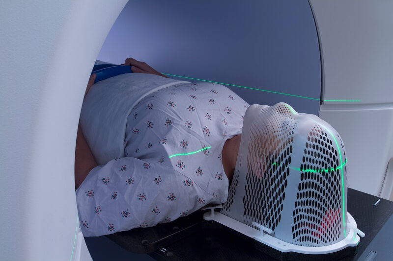 Head and neck radiotherapy - Complications | HealthStaffEd