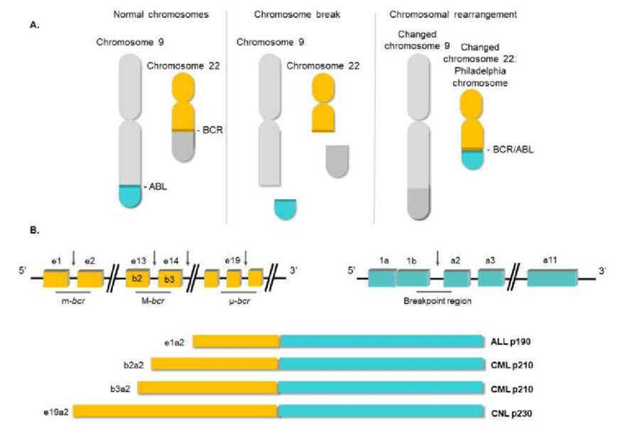 Diagnostico de la translocación t(9;22) (BCR/ABL) o Cromosoma Filadelfia