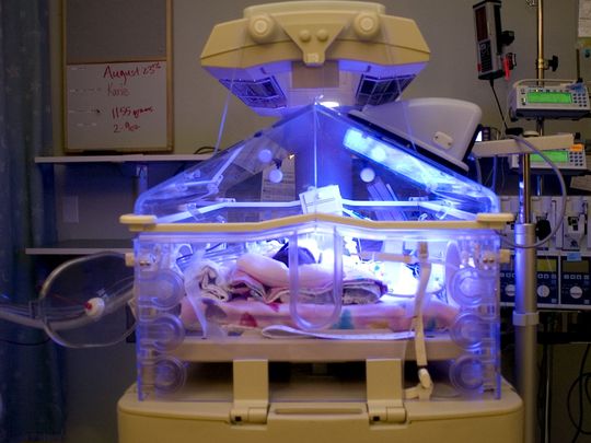 ASU graduates create medical device to cure jaundice
