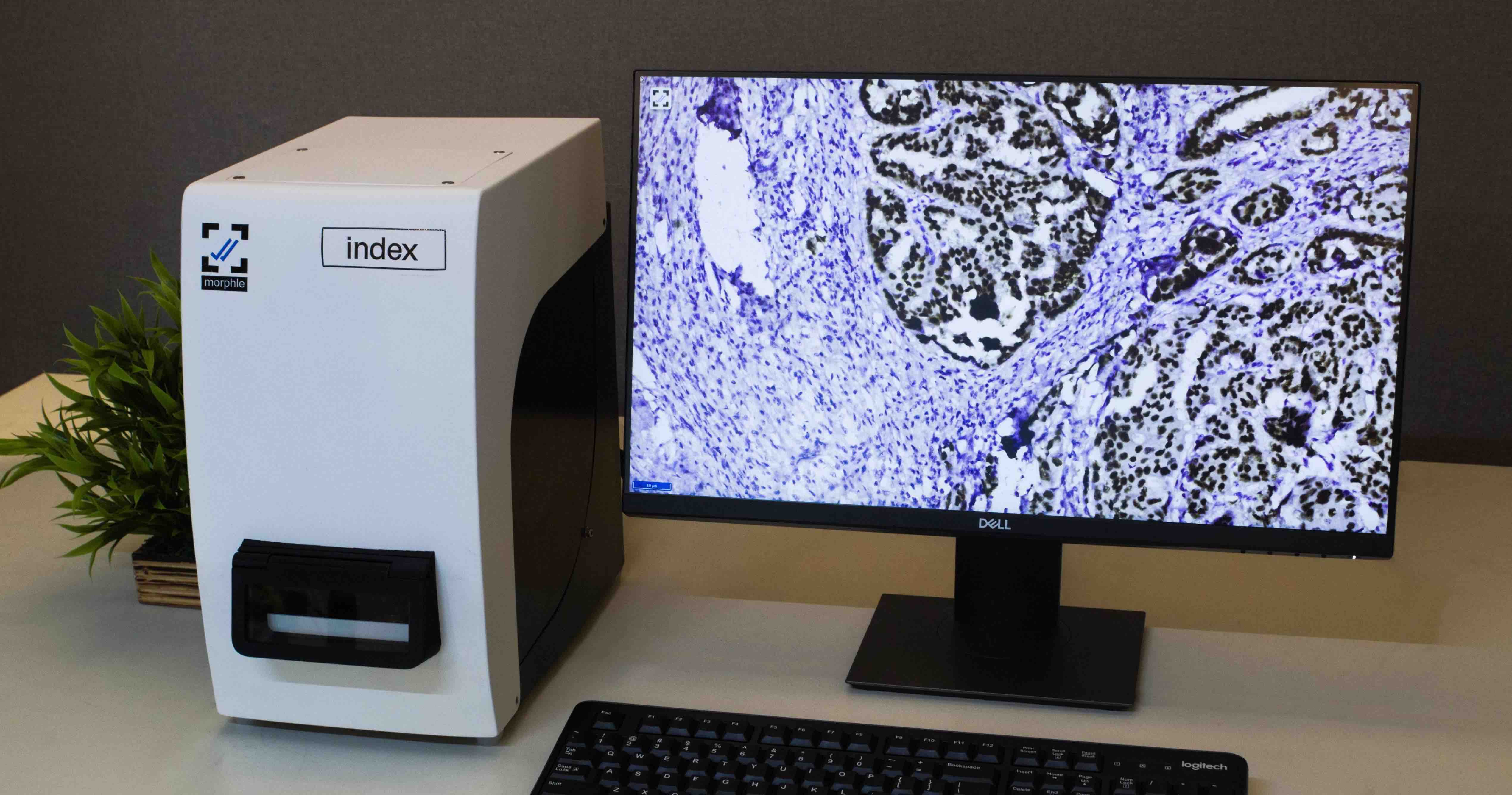 Index - the single slide scanner from Morphle Labs