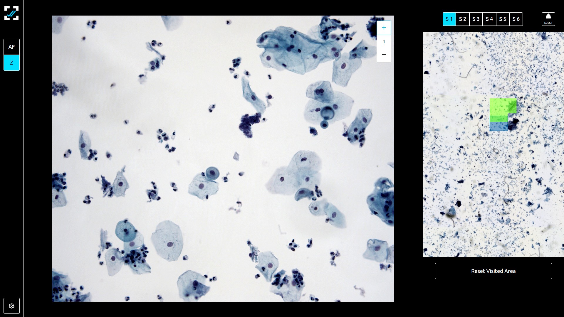 Morpholens 1 slide scanner | Morphle Digital Pathology
