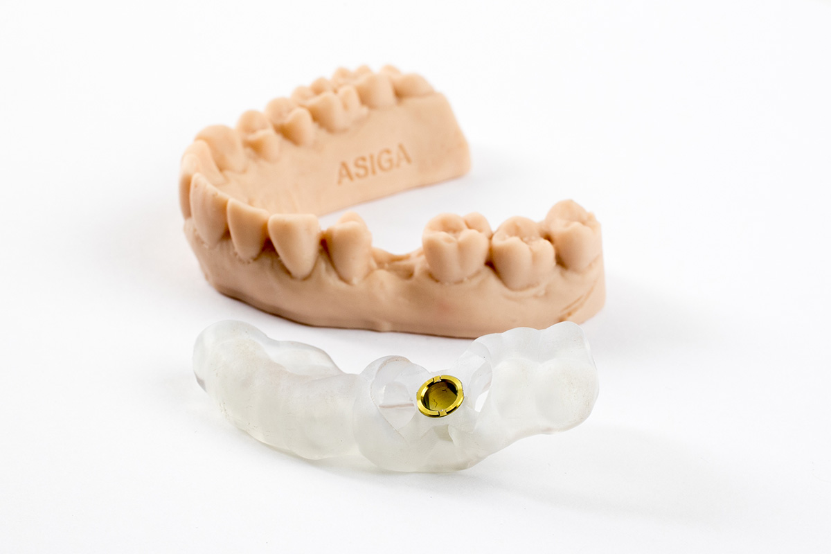 Asiga | Asiga MAX UV | MAPTEC