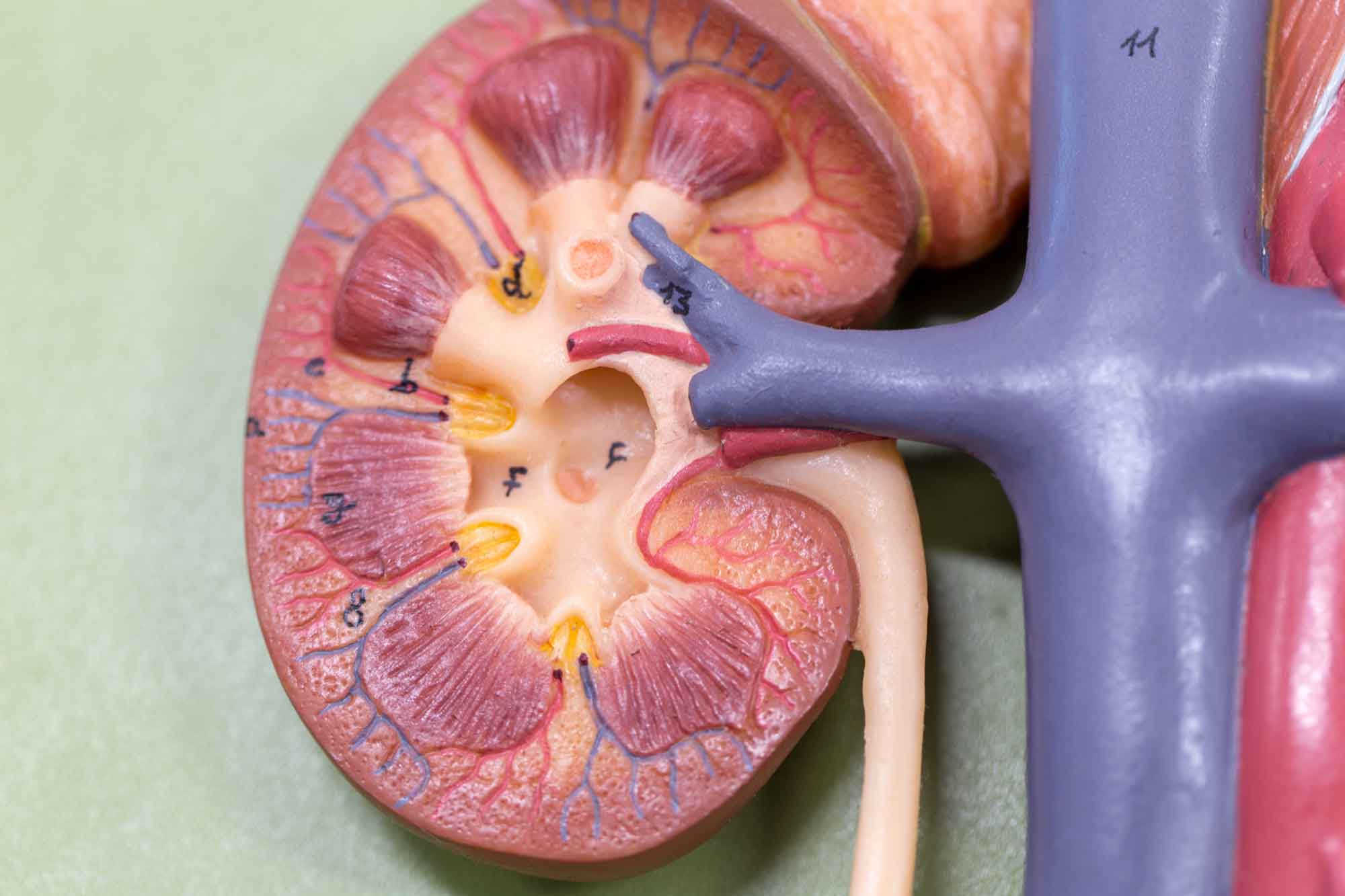 Dominando o manejo da nefrite lúpica