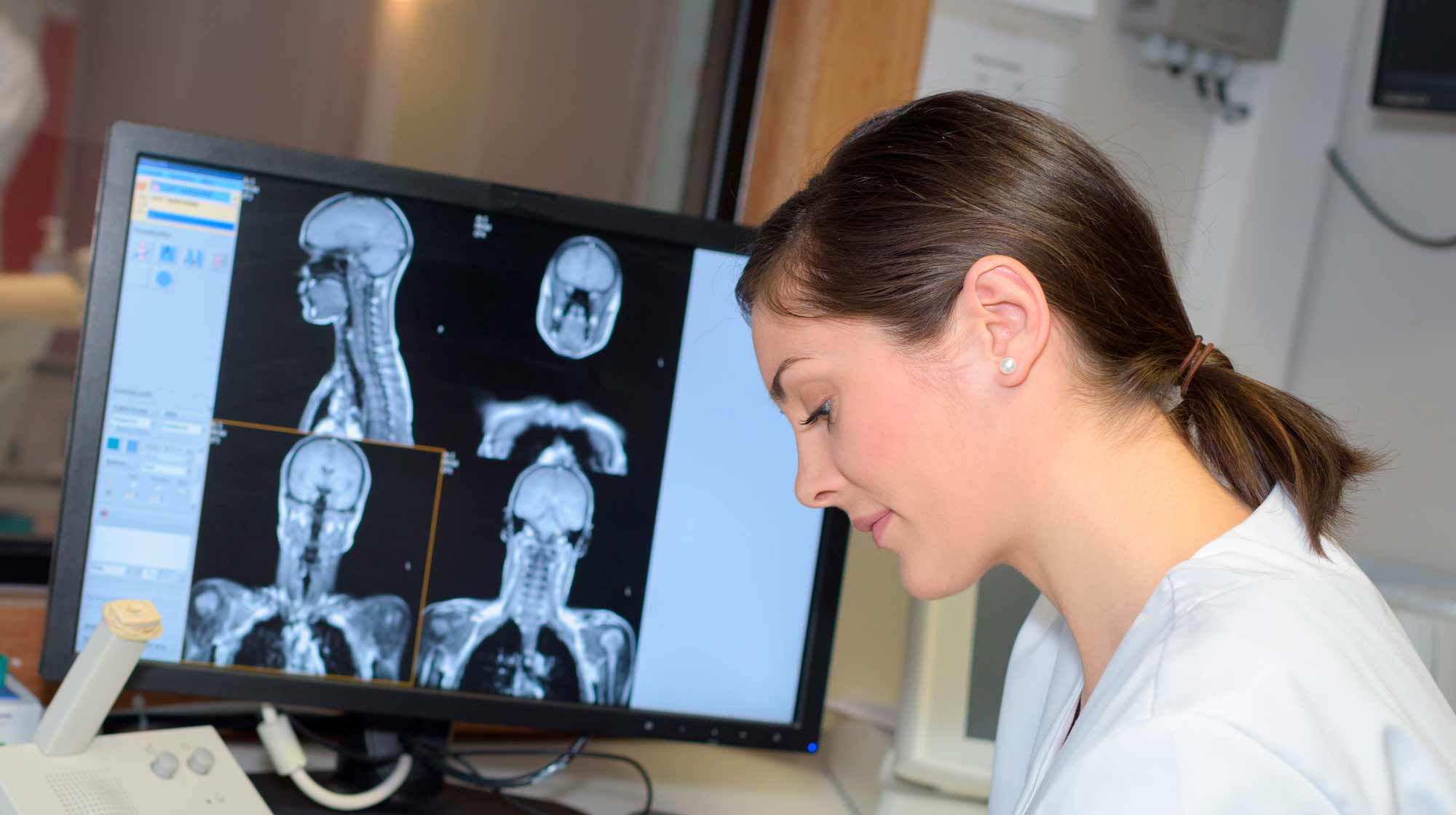 Traumatismo cranioencefálico (TCE): tipos de lesão e manejo do paciente