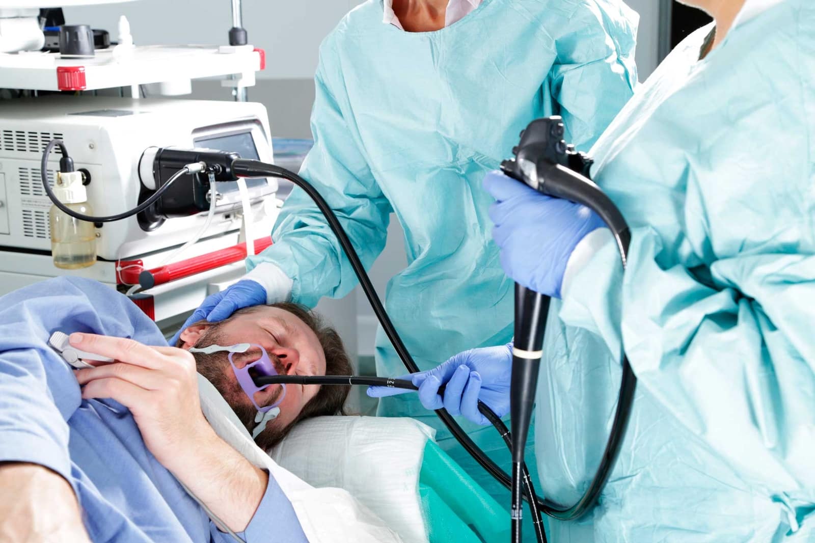 Esôfago de Barrett: O que é, Causas e Como Diagnosticar?