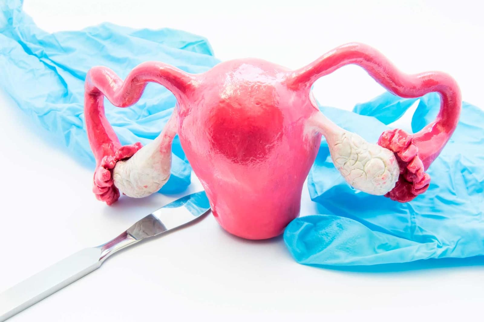 Histerectomia: o que é, indicações, tipos e cuidados pós operatório