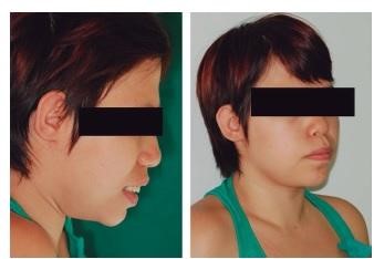 Talassemia: o que é, diagnóstico, tratamento e cenário atual no Brasil