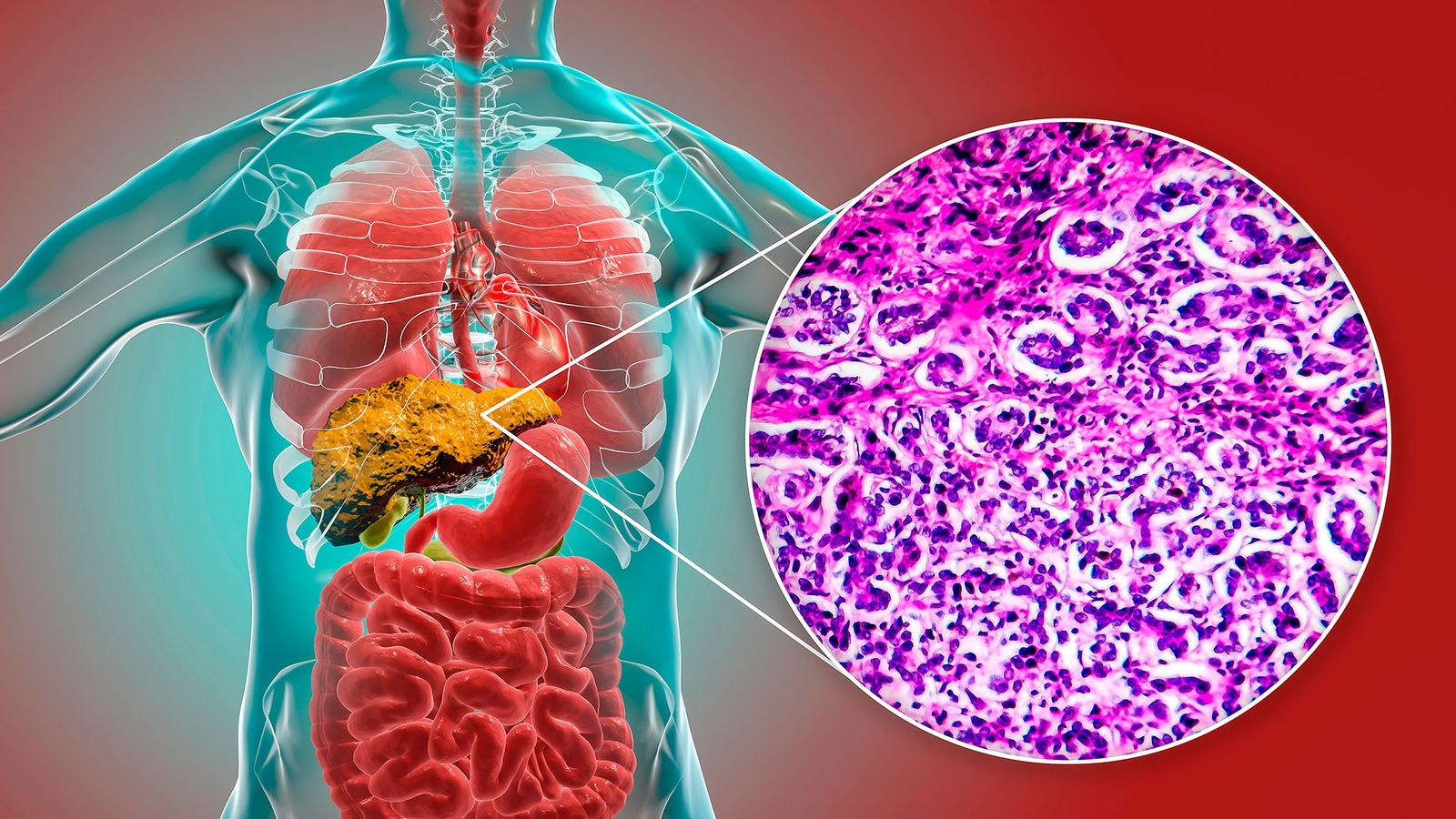 Cirrose: o que é, estágios e tratamento