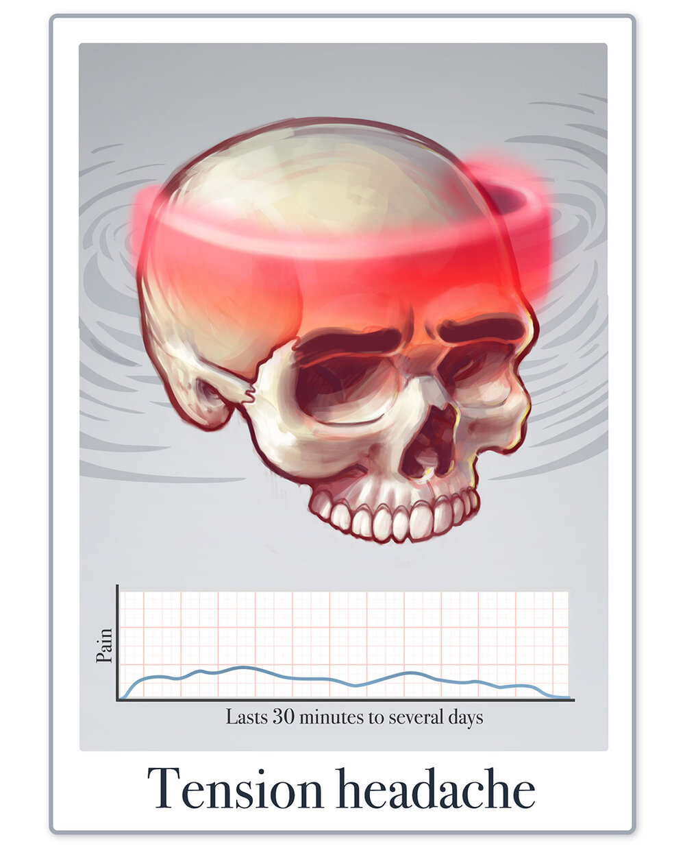 Cefaleia: O que é, Tipos, Sintomas e Como Diagnosticar?