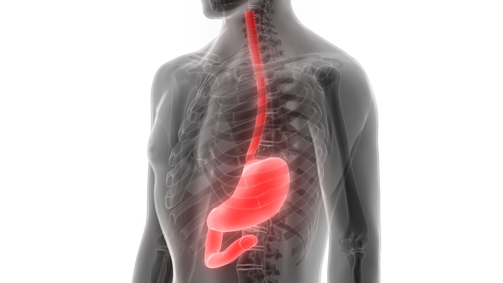 Esôfago de Barrett: o que é e como cai na prova de residência?