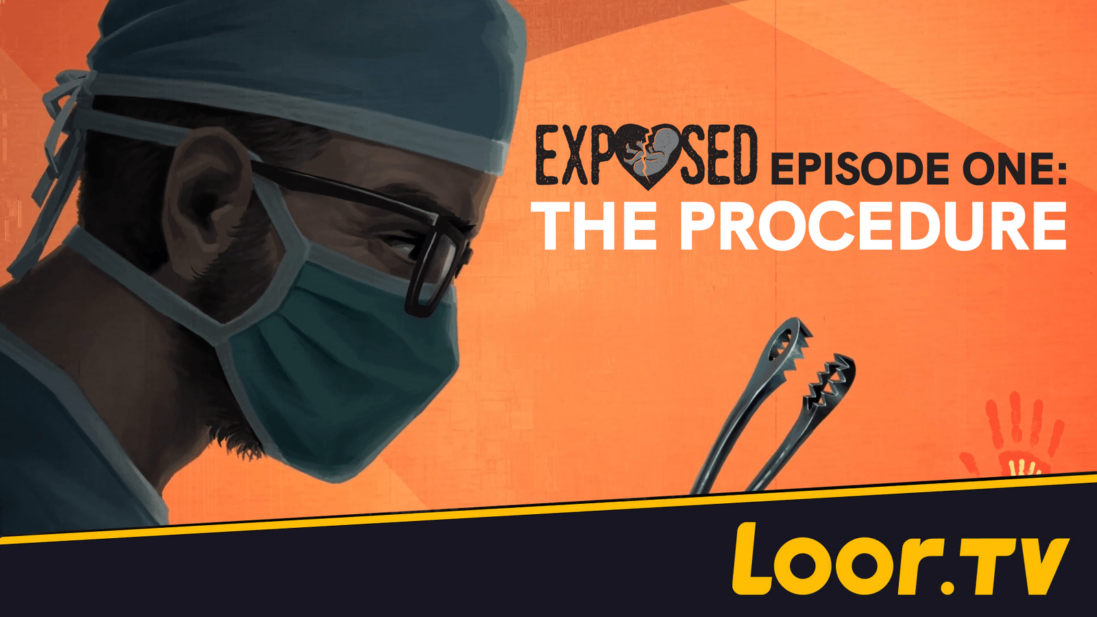 The Procedure, Animated by [Names Redacted], On LOOR