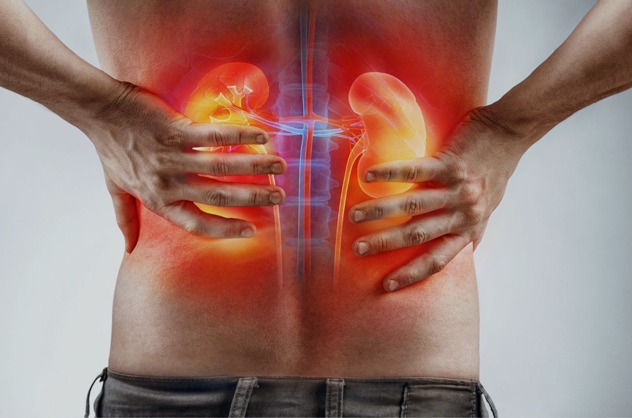 Kidney Disease: Symptoms, Treatment, Causes & Prevention - cult.fit