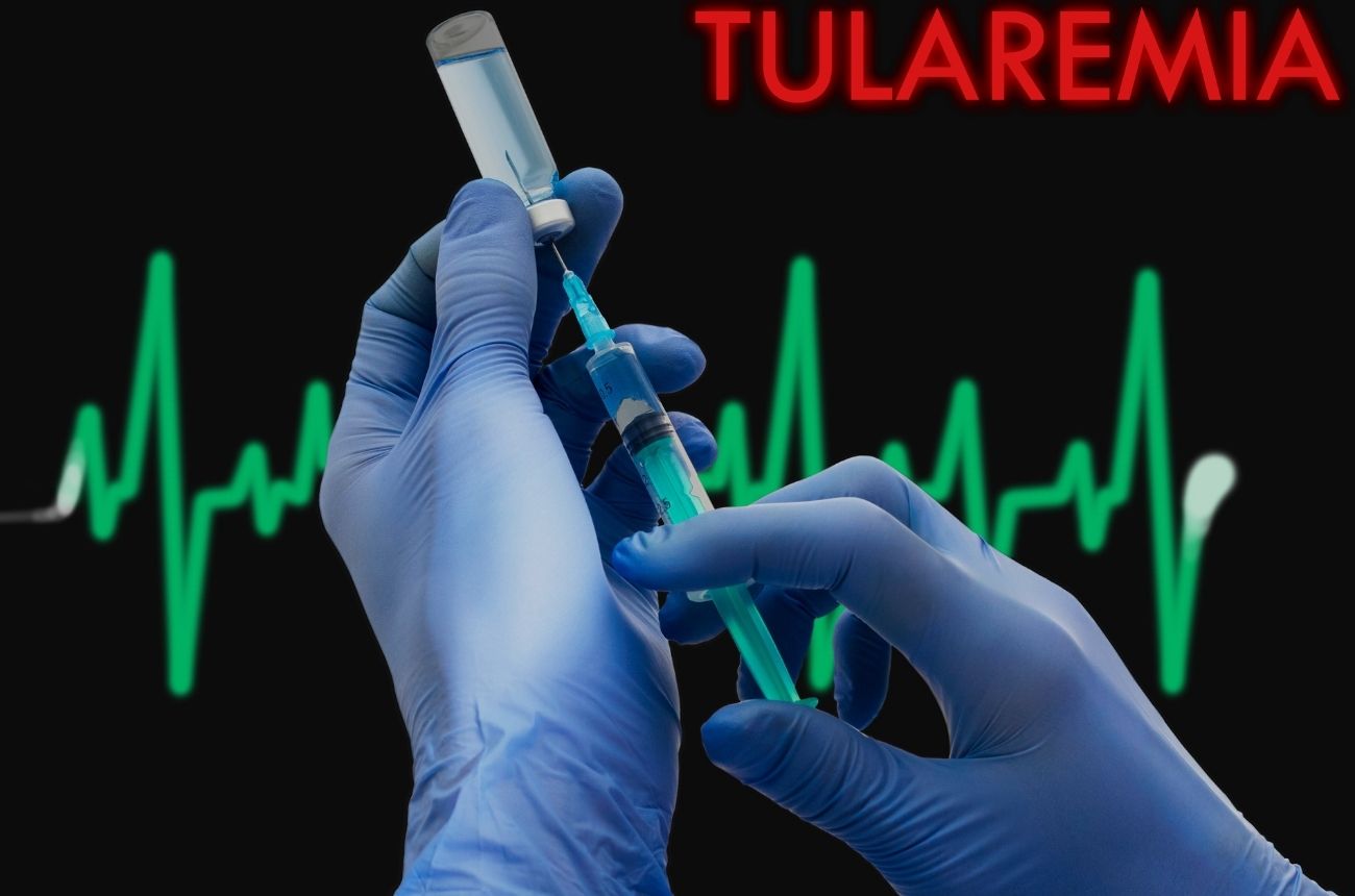 Tularemia: Symptoms, Causes, Treatment & Prevention | cult.fit