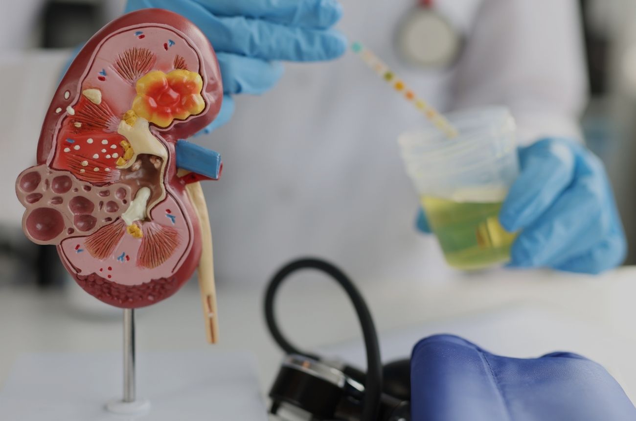 Online Kidney Function Test by blog.cult.fit