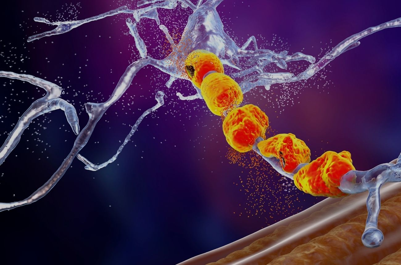 Motor Neuron Disease Types, Symptoms, Causes, Diagnosis, & Treatment At ...