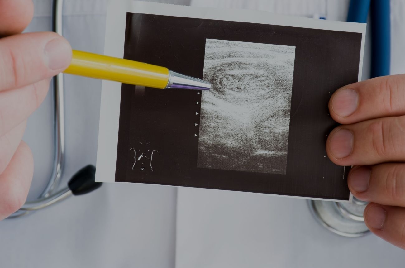 What is Intussusception? - Symptoms, Causes, & Treatment by blog.cult.fit