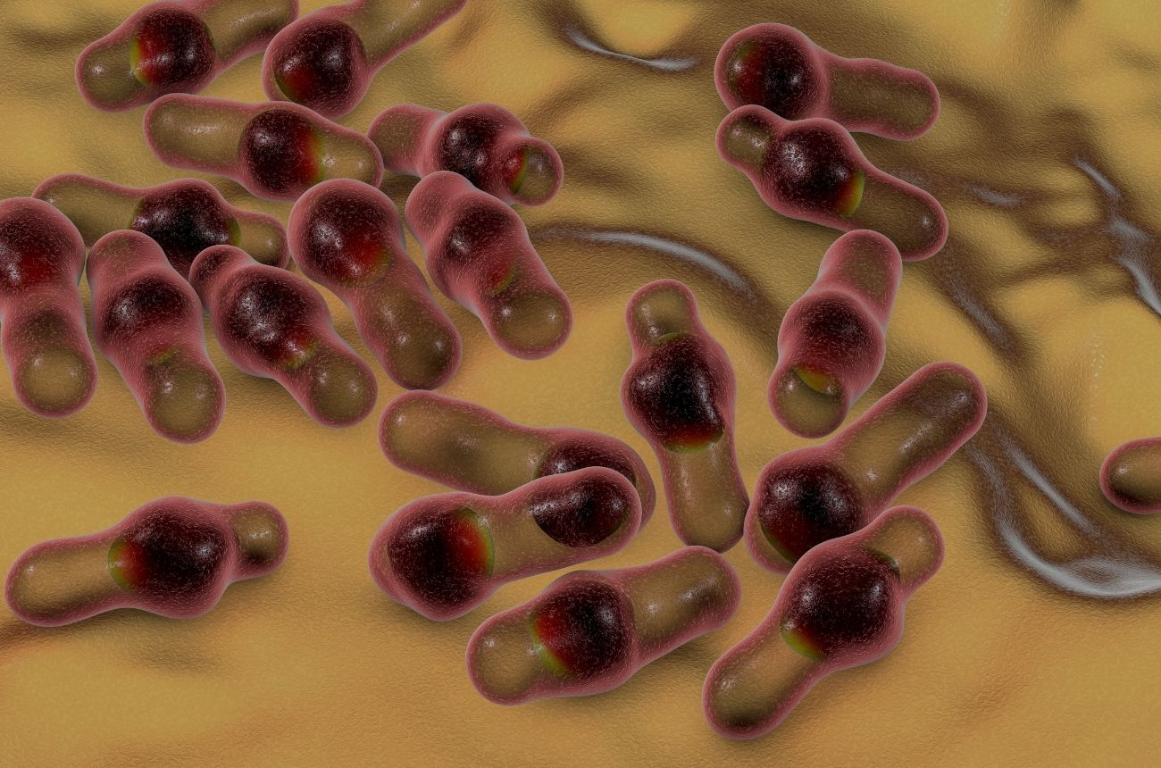 Gangrene: Types, Symptoms, Causes, Treatment, & Prevention | cult.fit