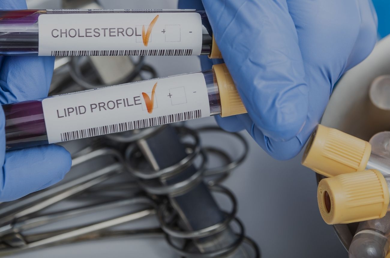 Dyslipidemia: Meaning, Symptoms, Causes, Treatment & More | cult.fit