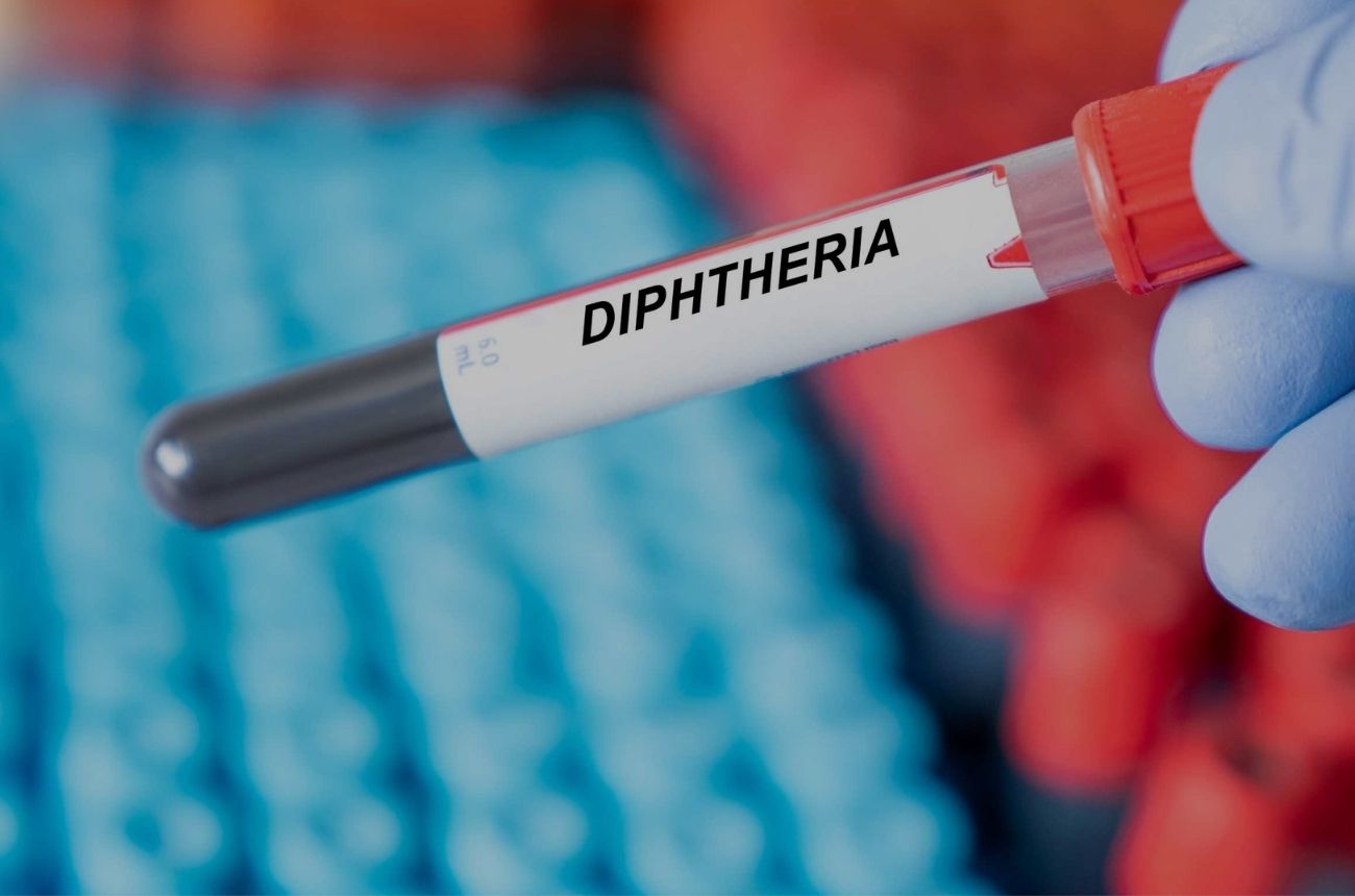 Diphtheria: Symptoms, Causes, Diagnosis & Treatment | cult.fit