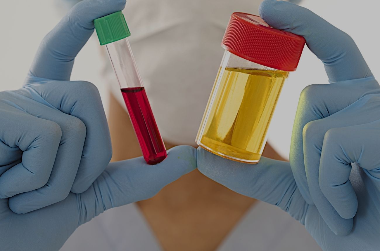 Blood in Urine - What Are the Symptoms and Causes | cult.fit