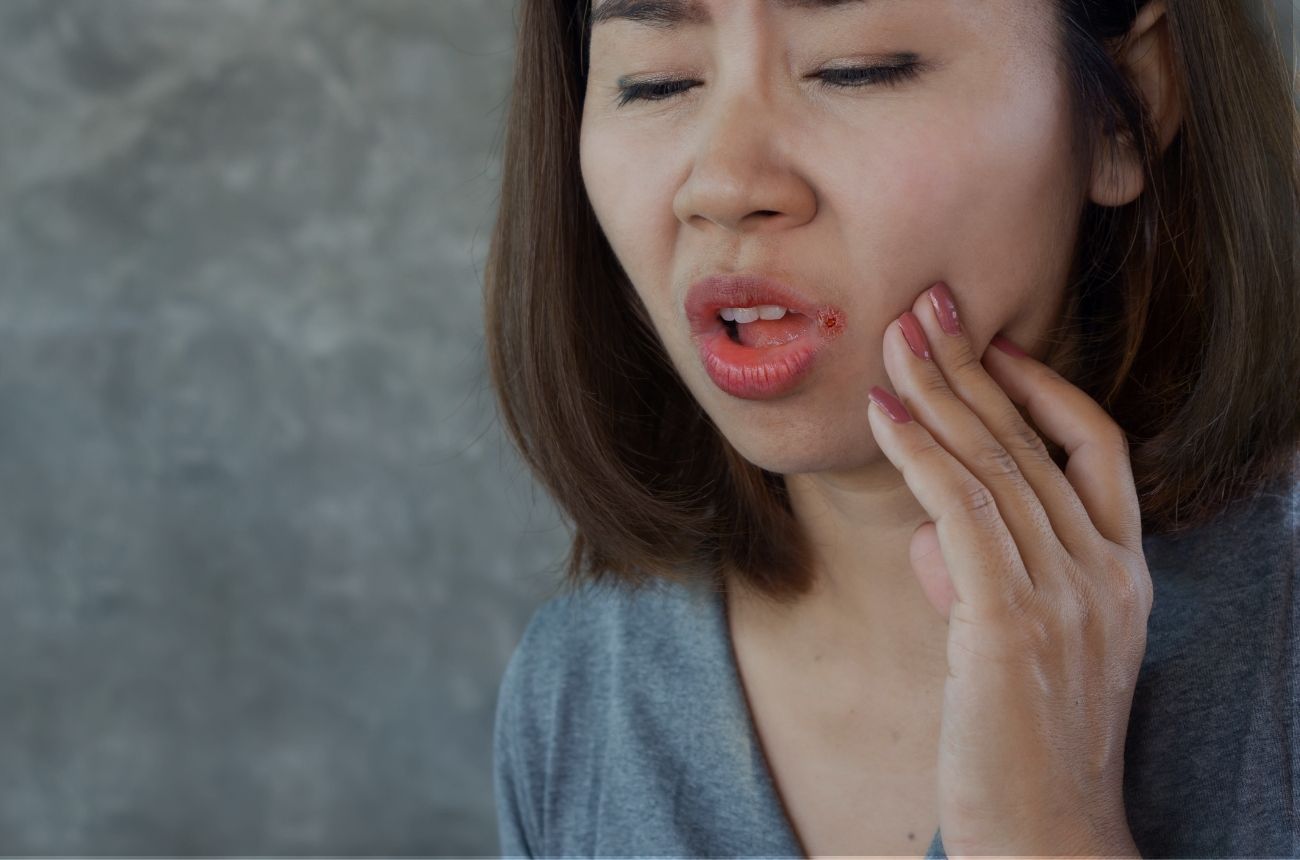 Angular Cheilitis: Treatment, Cure, Causes, Symptoms & More| cult.fit