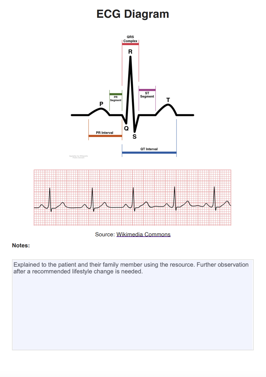 Electrocardiogram Diagram