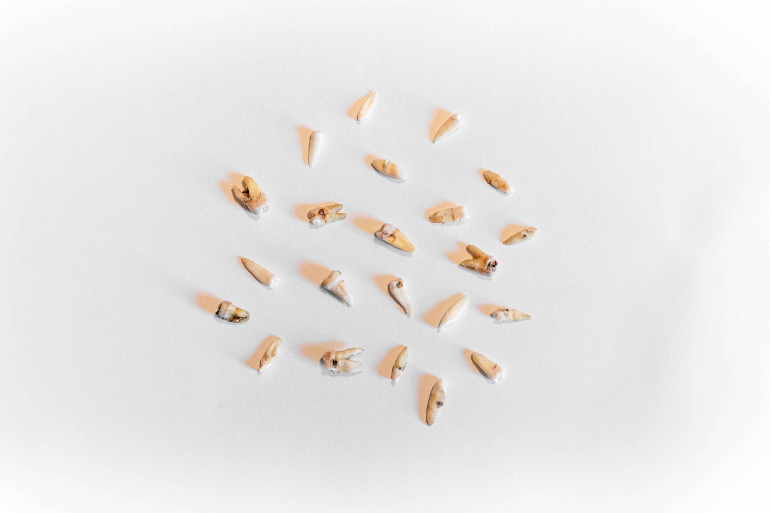 Teeth | JonsBones: Responsibly Sourced Human Osteology