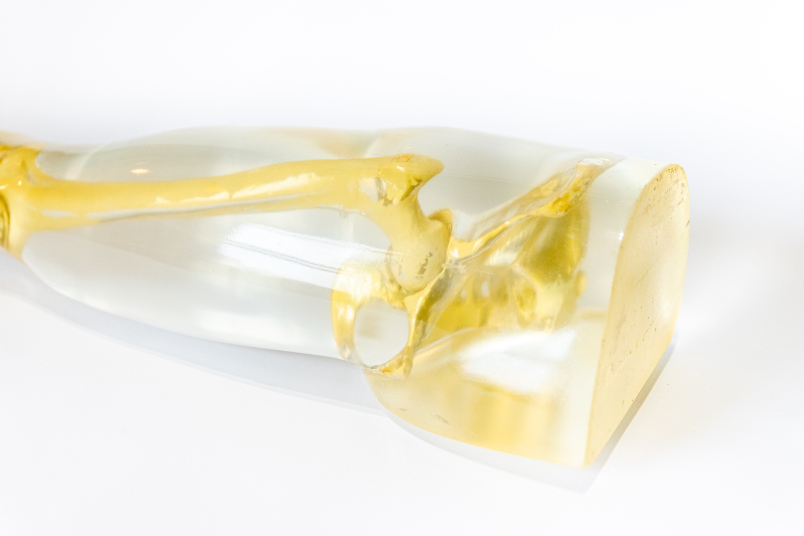 Phantom Leg And Pelvis | JonsBones: Responsibly Sourced Human Osteology