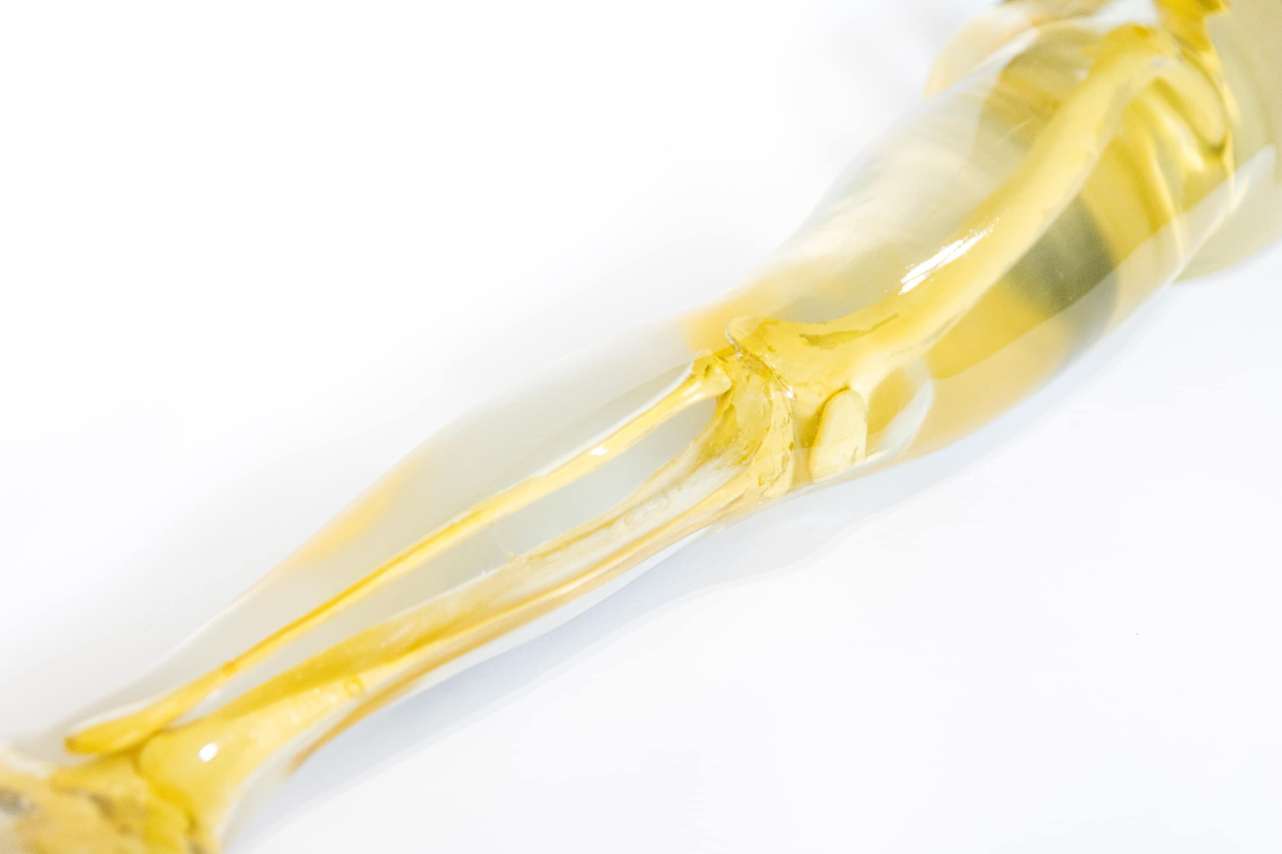 Phantom Leg And Pelvis | JonsBones: Responsibly Sourced Human Osteology