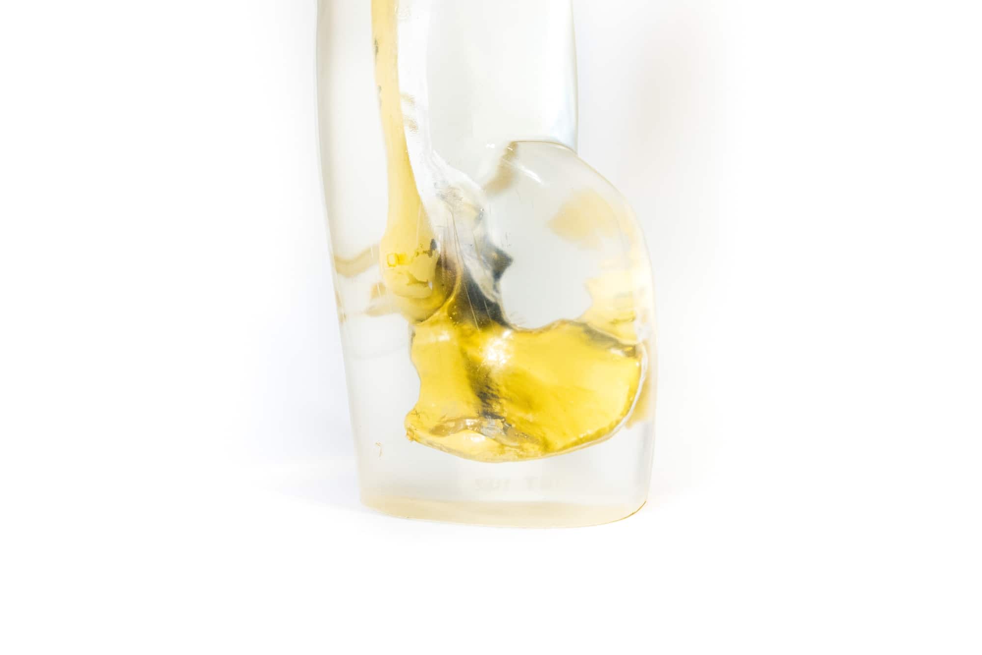 Phantom Leg And Pelvis | JonsBones: Responsibly Sourced Human Osteology