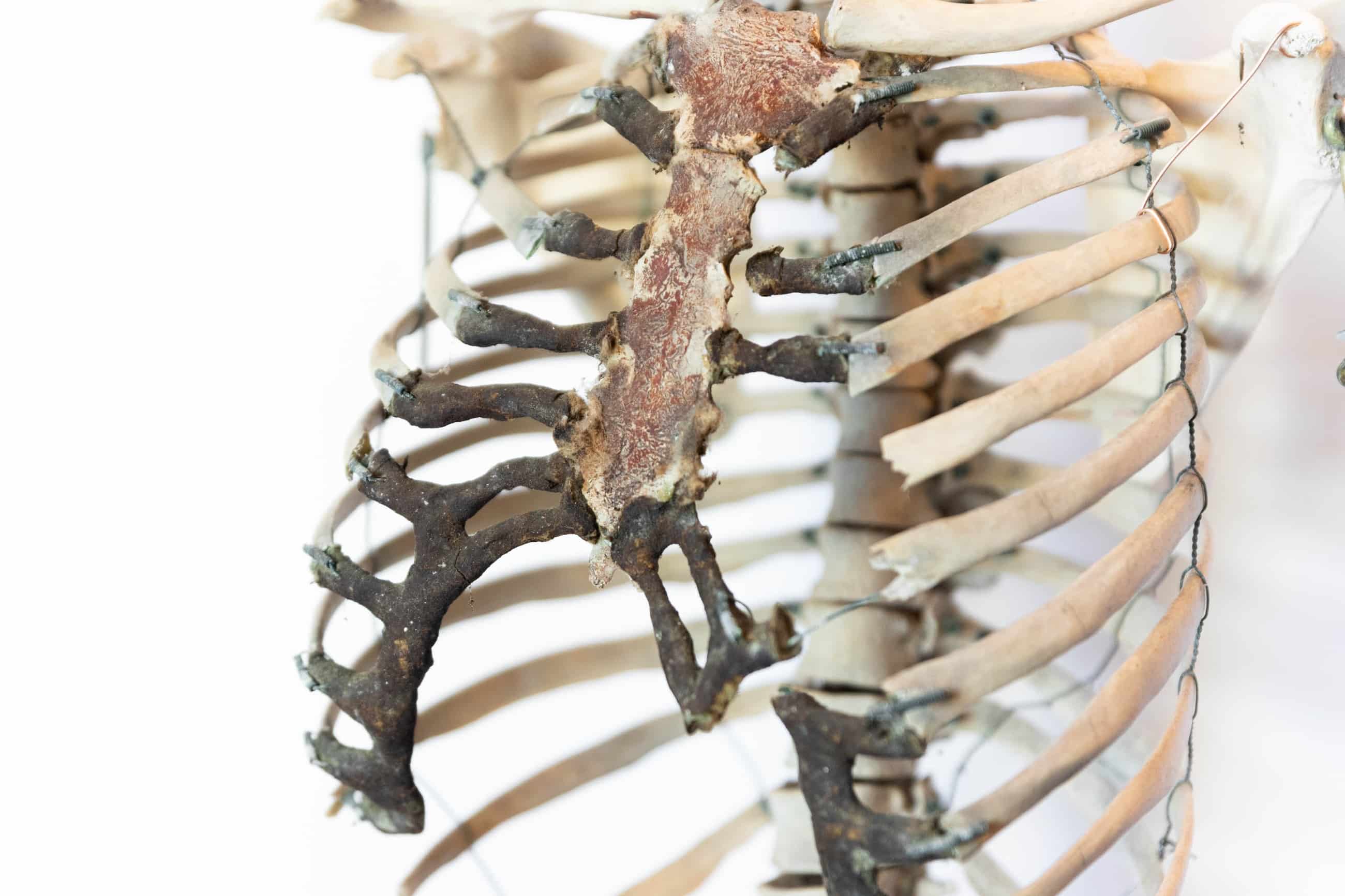 Human Torso and Skull (0913) | JonsBones: Responsibly Sourced Human ...