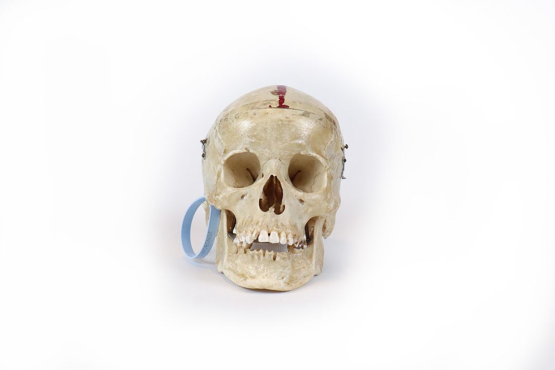 Phantom Skull | JonsBones: Responsibly Sourced Human Osteology