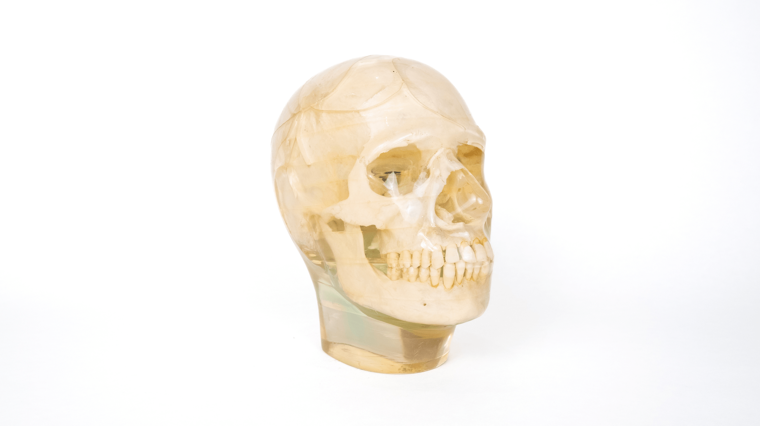 Phantom Skull (007) | JonsBones: Responsibly Sourced Human Osteology