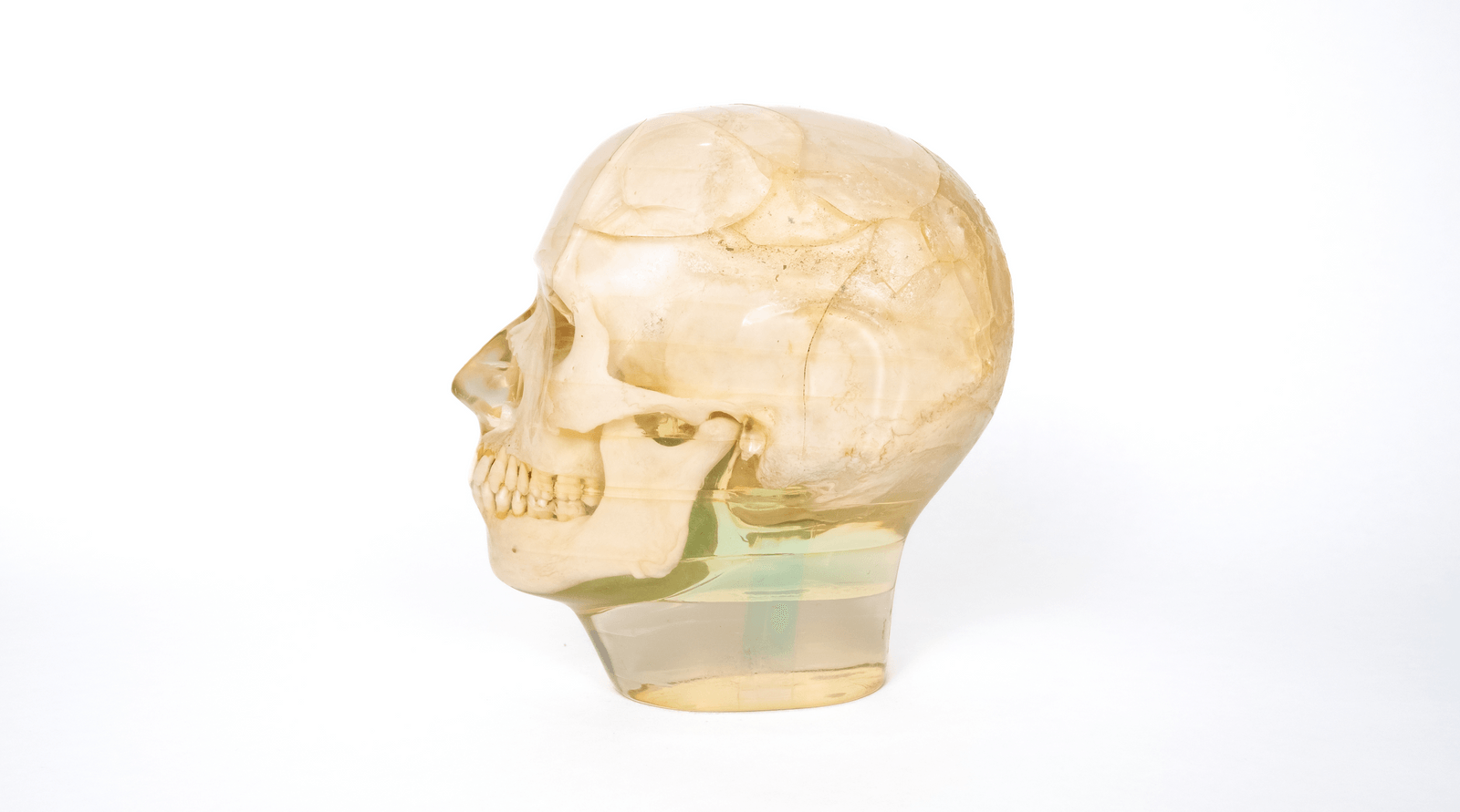 Phantom Skull (007) | JonsBones: Responsibly Sourced Human Osteology