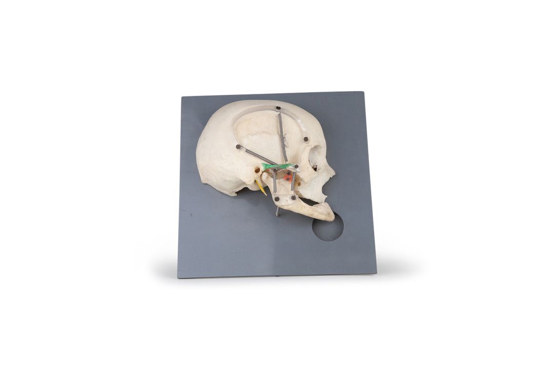 German Sagittal Cut Human Skull on Acrylic Base (0051) | JonsBones ...