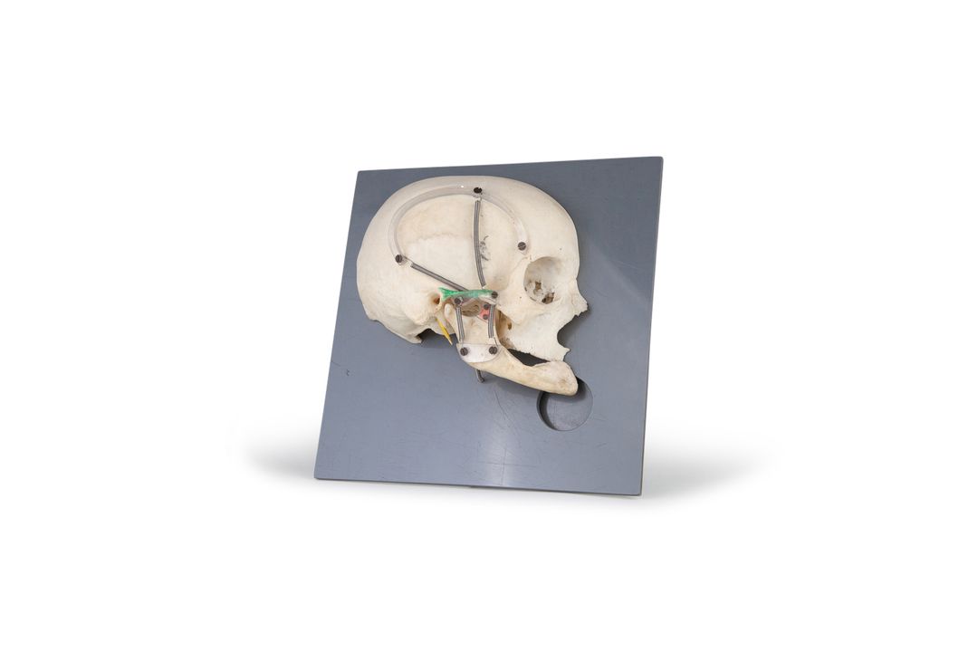 German Sagittal Cut Human Skull on Acrylic Base (0051) | JonsBones ...