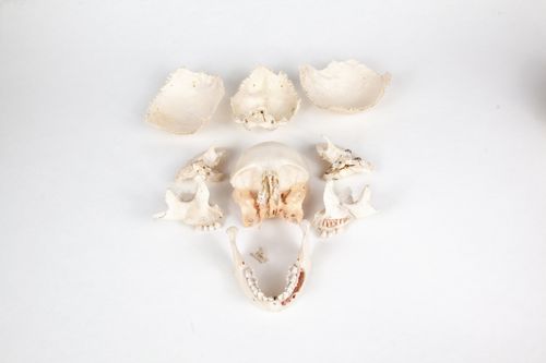 Disarticulated Skull (0224) | JonsBones: Responsibly Sourced Human ...