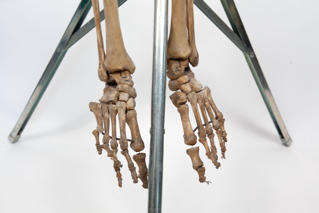 Antique Adam, Rouilly Articulated Skeleton (0923) | JonsBones ...