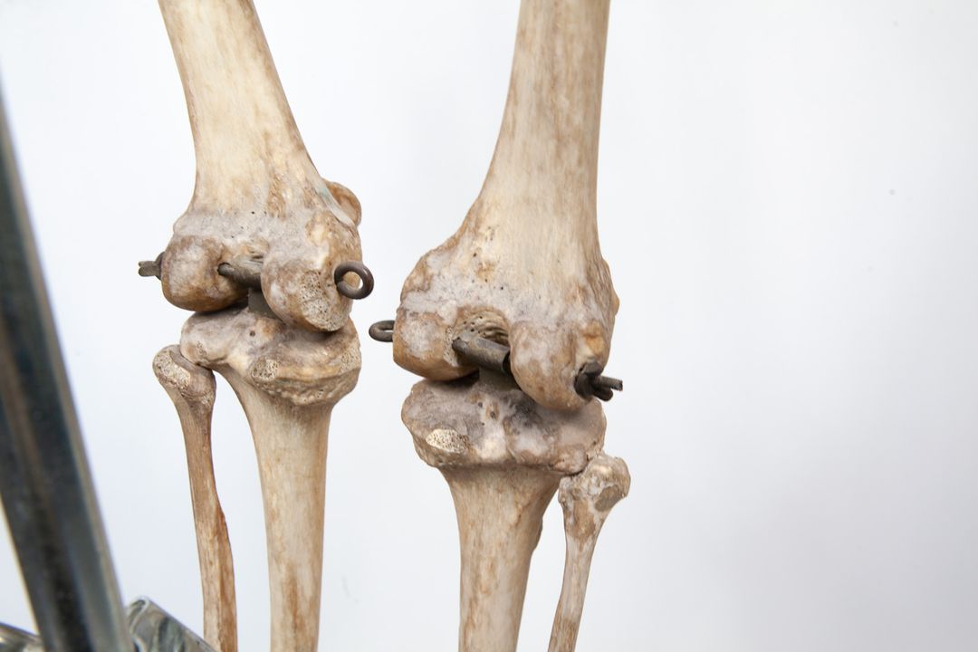 Antique Adam, Rouilly Articulated Skeleton (0923) | JonsBones ...