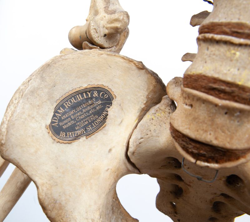 Antique Adam, Rouilly Articulated Skeleton (0923) | JonsBones ...