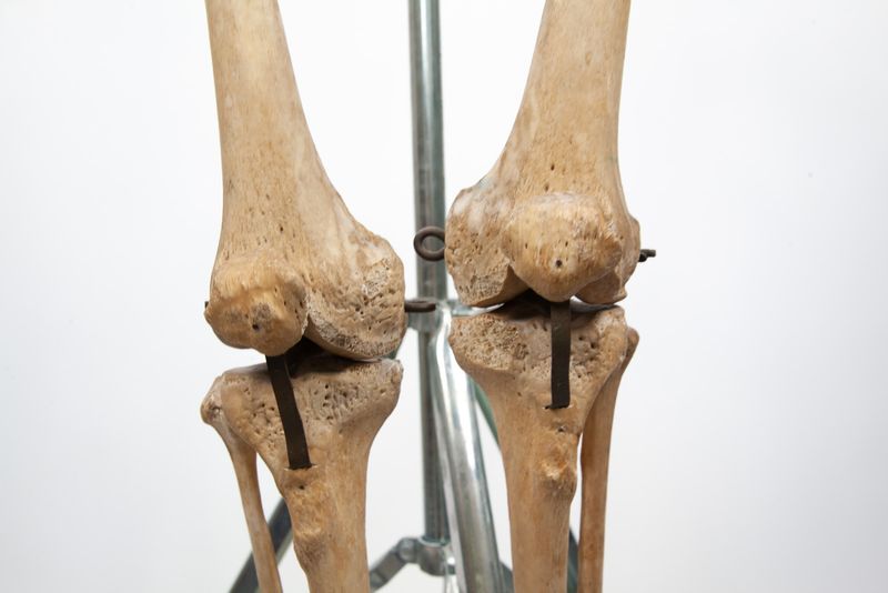 Antique Adam, Rouilly Articulated Skeleton (0923) | JonsBones ...