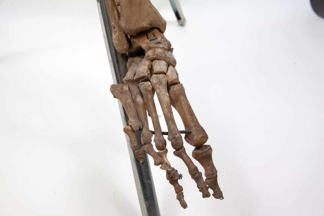 Antique Adam, Rouilly Articulated Skeleton (0923) | JonsBones ...