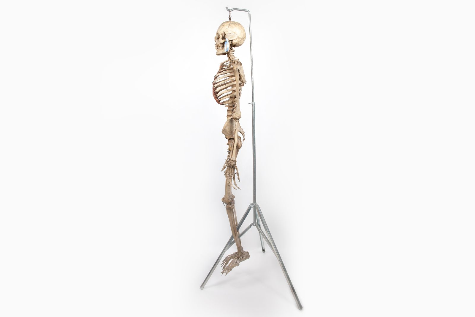 Antique Adam, Rouilly Articulated Skeleton (0923) | JonsBones ...