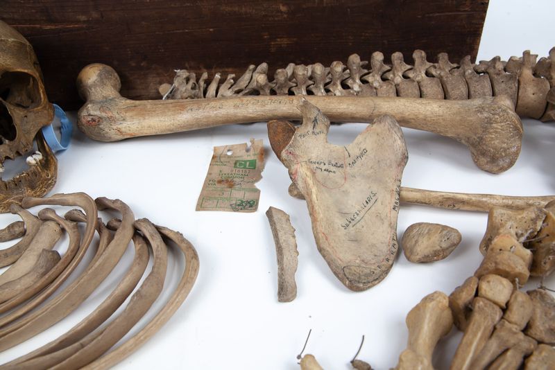 Half-Skeleton Bone Box (0244) | JonsBones: Responsibly Sourced Human ...