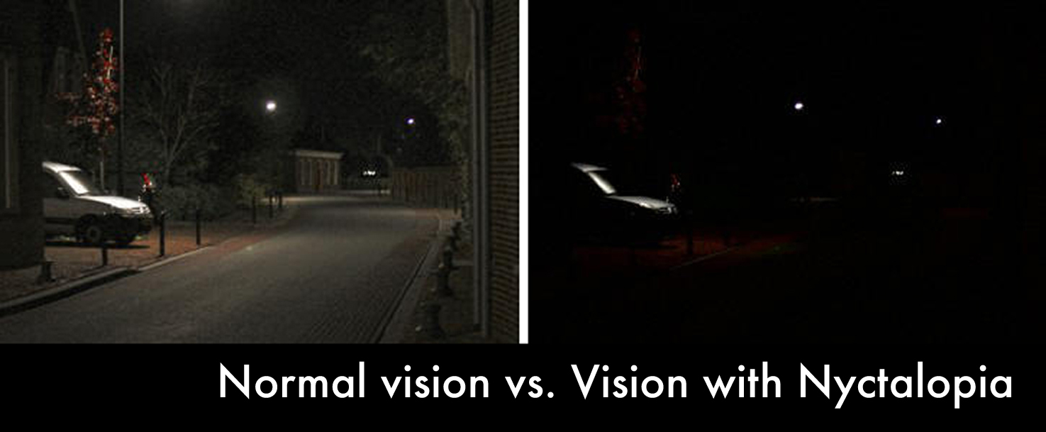 The rarest eye diseases | TACIR Ophthalmological Clinic