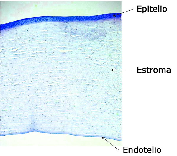 Fotoqueratitis: el lado más oscuro del sol | Clínica Oftalmológica TACIR