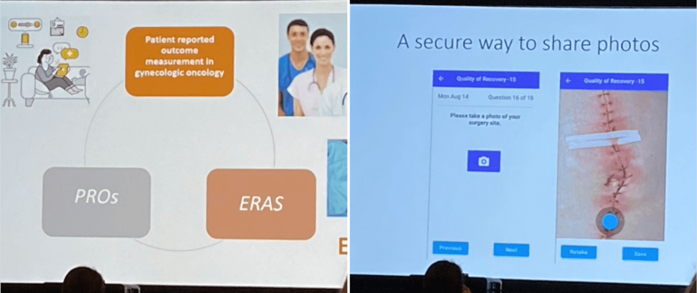 SeamlessMD | 5 Big Takeaways from ERAS USA 2022