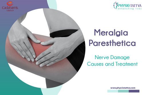 Meralgia Paresthetica: Symptoms, Causes & Treatment